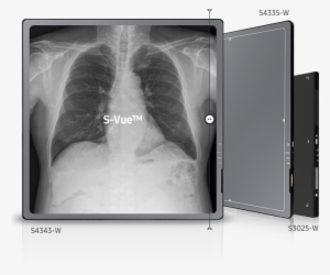 Radiography Transparent PNG - 653x616 - Free Download on NicePNG